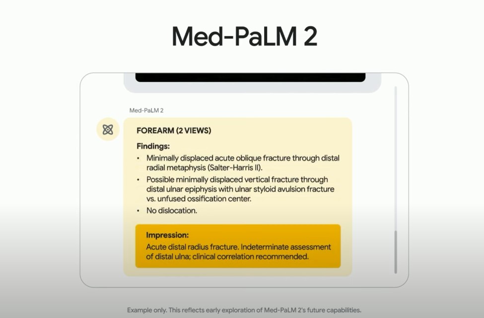 Intelligence Artificielle